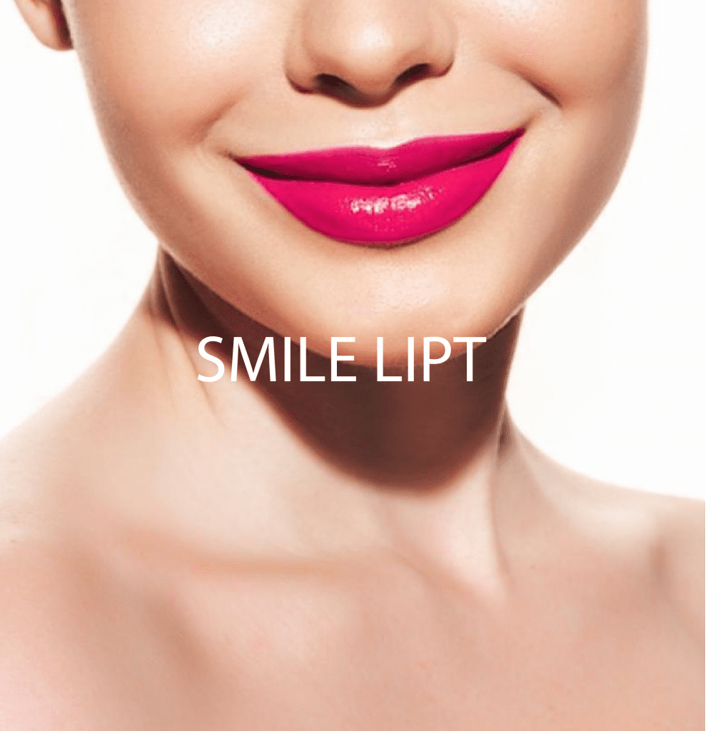 微笑線手術 - 雅里絲醫美診所